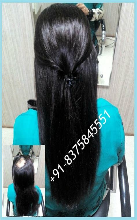 Hair Wigs In Noida Best Hair Wigs Services In Noida