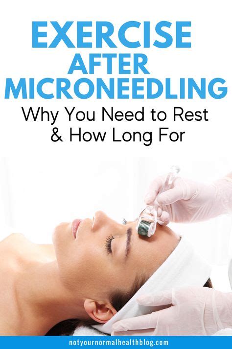 Top 10 After Microneedling Ideas And Inspiration
