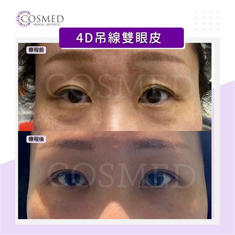 Cosmed 專營水光保濕及輪廓修正