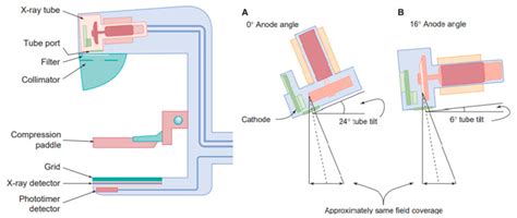 Breast Imaging Physics In Mammography Part I PMC