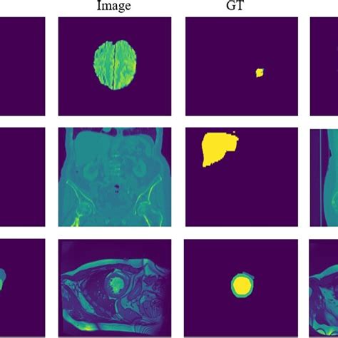 visual representation of input medical images with ground truth