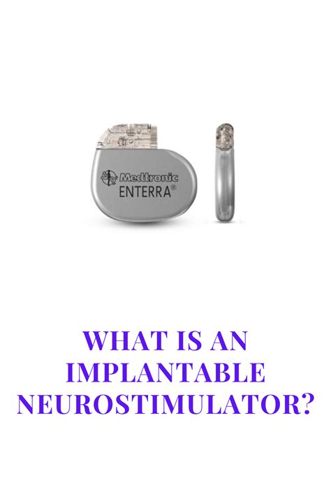 What Is An Implantable Neurostimulator Medical Imaging Epidural