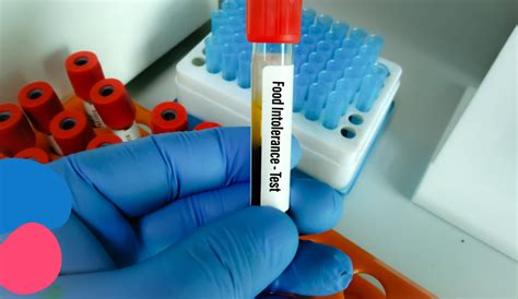 Test Per Intolleranze Alimentari Quanto Costa Doctolib