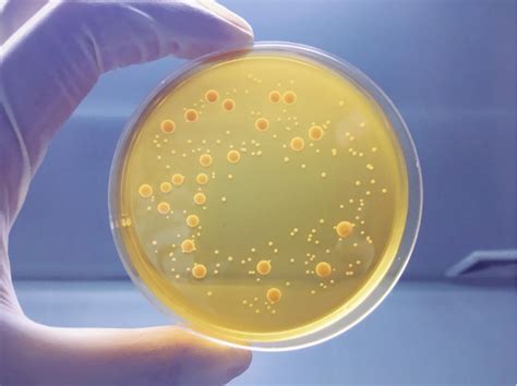 Can Escherichia Coli Grow On Nutrient Agar