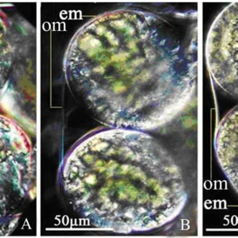 Copepod Egg Structure Before And After Heat Treatment A Eggs Before Download Scientific