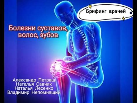 Заболевания суставов, волос, зубов. Би-лурон. Брифинг врачей. - YouTube