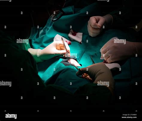 Close Up Of A Surgeons Hands Stitching A Patients Skin Incision Stock