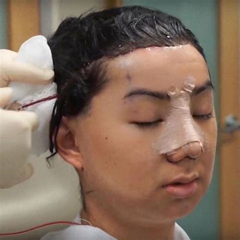 Nikita Draguns Plastic Surgery Journey — Before And After