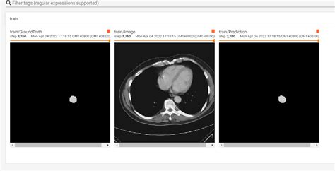 Tensorboard The Image Cannot Be Displayed Correctly Issue Hucaofighting Swin Unet Github