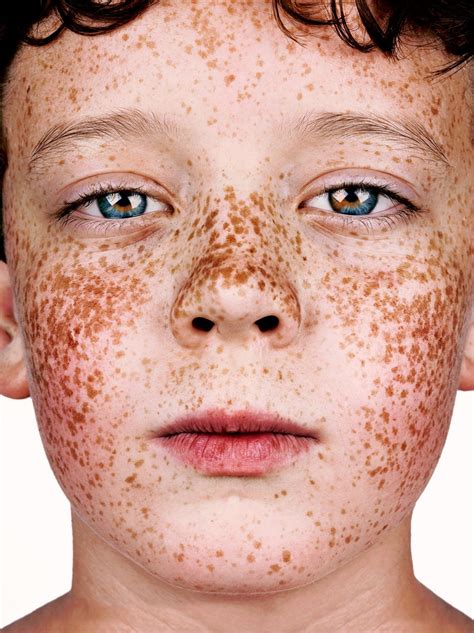 Freckles Photography Exhibition Sweden By Photographer Brock Elbank