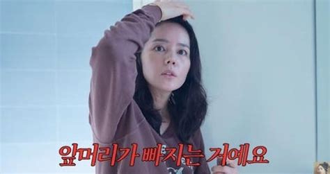 한가인 탈모 고민 토로 원래 머리숱 많아둘째 낳고 정수리 탈모 생겨