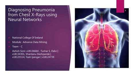 Pneumonia Detection Using Cnn Ppt