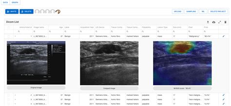 Github Beoks Web Dicom Management Dicom Database Management For Medical Ml Project Based On Web