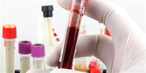 Serial Blood Testing