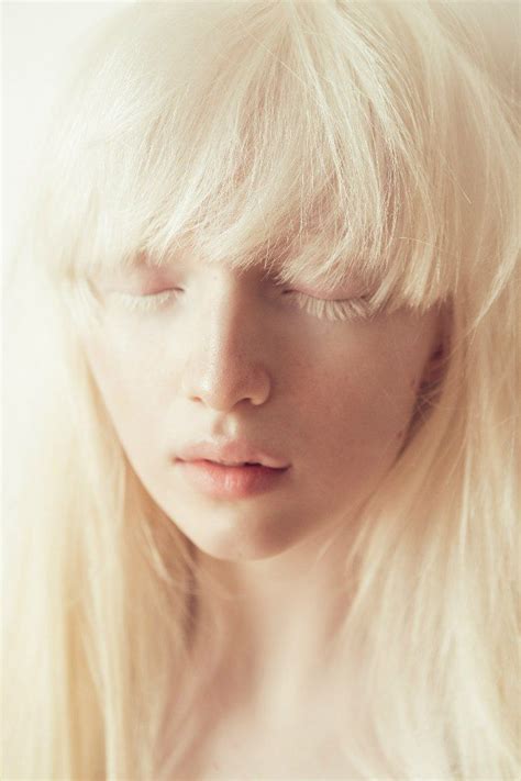 Nastya Zhidkova Albino Girl Albino Model Pale Beauty