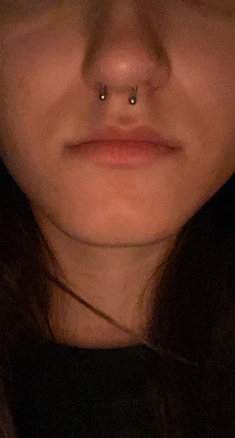 Piercing Irritation Bump Wont Go Away No Matter What I Do Its Been