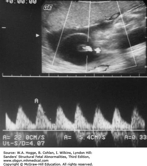 Miscellaneous Abnormalities Radiology Key
