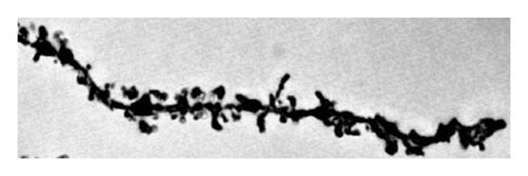 Representative Photomicrographs Of Oblique Dendritic Segments From