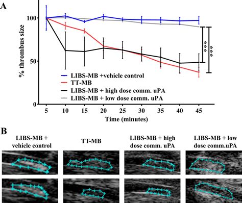 Proof Of Thrombus Theranostic Monitoring Of Thrombolysis Via Molecular
