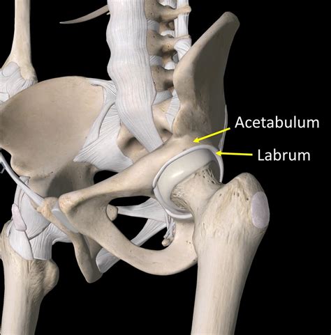 Treating An Acetabular Cyst And Healing The Hip Socket Regenexx