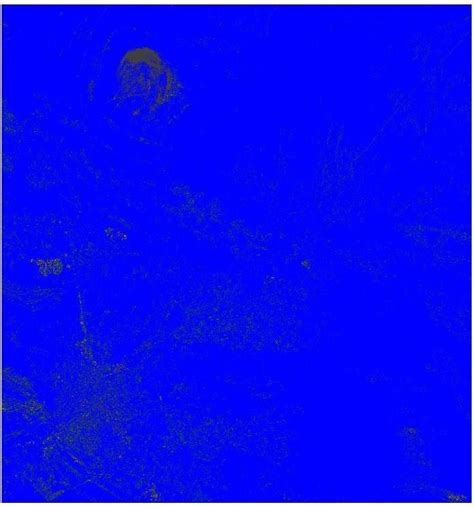 Anomalies By The Laplacian Method Comparing The Figs 3 And 12 One Can