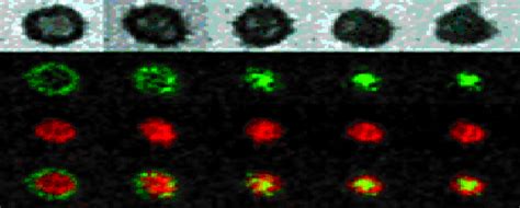 T Cell Accumulation Of Mhc And Icam And The Formation Of An