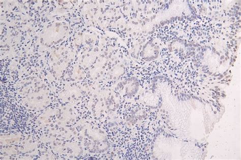 Phospho Tau Ser199 Recombinant Rabbit Monoclonal Antibody 23e8
