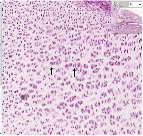 Ossification Flashcards Quizlet