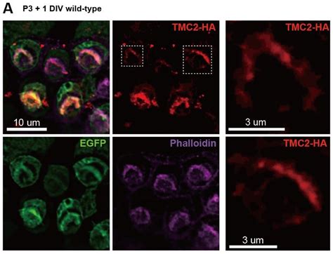 Figure Supplement 1 Localization Of 195 Ectopically Expressed TMC2 In