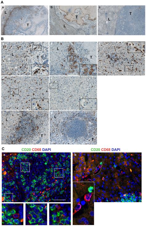 Localization Patterns Of Cd68 Positive Macrophage Populations Across