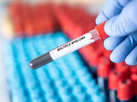 The Importance Of Blood Tests In Diagnosing Multiple Myeloma
