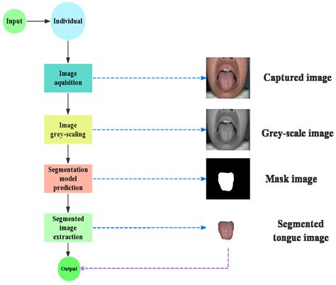 Tonguenet A Precise And Fast Tongue Segmentation System Using U Net With A Morphological