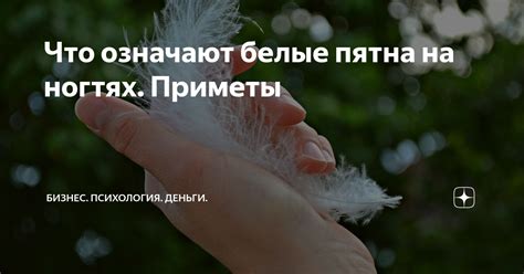 Что означают белые пятна на ногтях Приметы Бизнес Психология