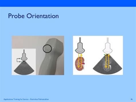 Basics Physics Of Ultrasound