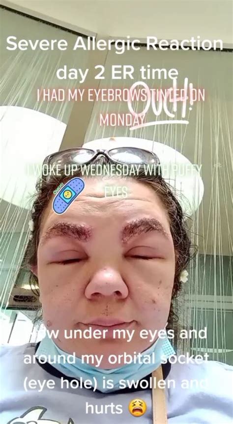 I Was Scar From Lion King After Botched Eyebrow Tint Job