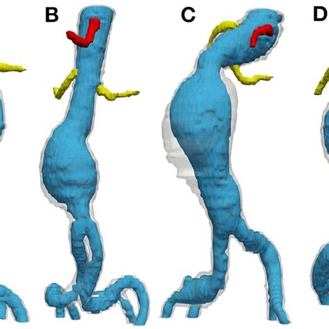 3D Reconstruction Obtained From The Results Of The Automatic