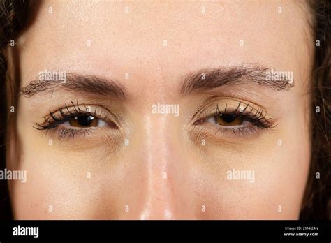 Macro Of Myopic Girls Eyes As She Squints To See Better Concept Of