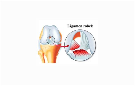 Ligamen Pengertian Struktur Fungsi Bagian Jegeristik