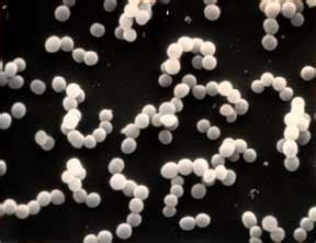 El blog de l Associació de Biotecnòlegs de Catalunya Las bacterias del ácido láctico I