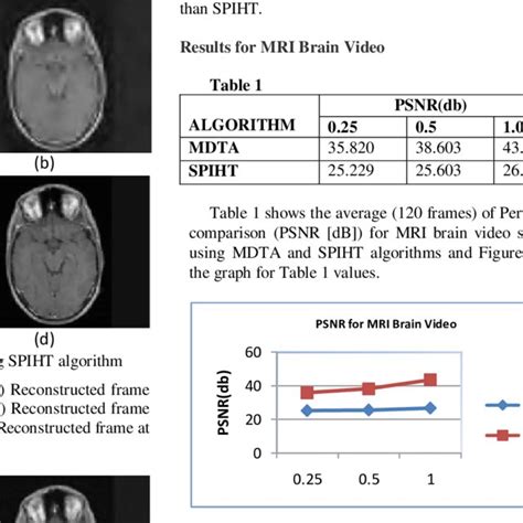 performance comparison for mri brain video between mdta and spiht an