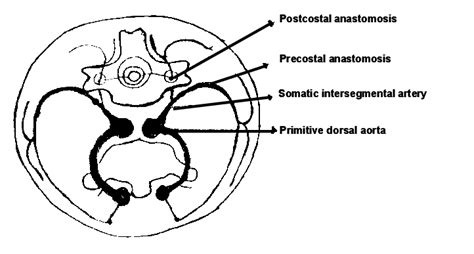 Diagrmatic Representation Of Intersegmental Arteries Fetal Stage