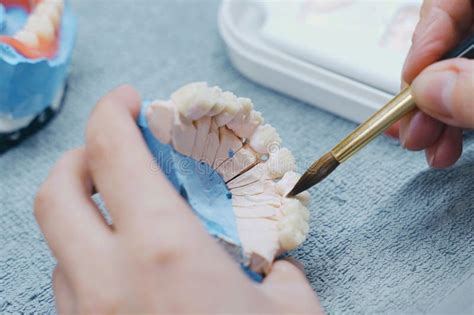 A Dental Technician Paints a Denture with a Brush. Stock Photo - Image ...