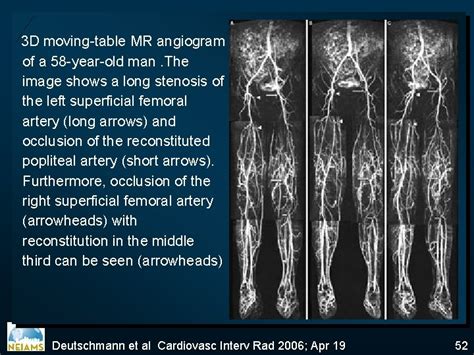 Peripheral Arterial Disease Simulation Training Curriculum 1 Peripheral