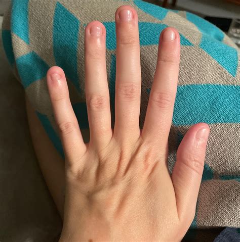 Been Biting My Nails For 30 Yrs Just Got Engaged And Want To Show Off