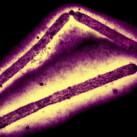 Why H5n1 Bird Flu Is Keeping The Cdcs Top Flu Scientist Awake Stat