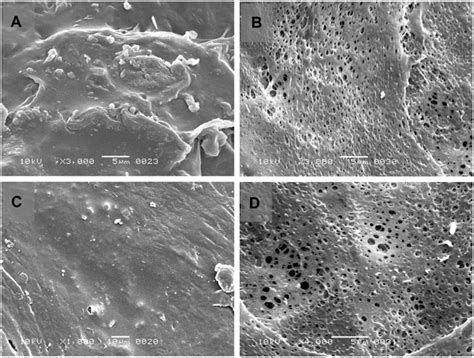 Frontiers Sedem Tool Driven Full Factorial Design For Osmotic Drug Delivery Of Tramadol Hcl