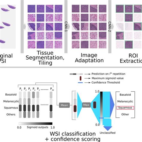 test performance of the pathology deep learning system in each of the 3