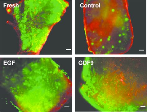 Fluorescent Staining With Calcein Am Ethidium Homodimer 1 Immediately