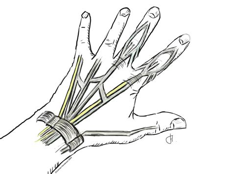 Extensor Tendon Anatomy James Henderson Specialist Plastic And Hand