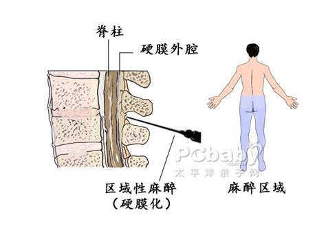 剖腹产全过程科普图库亲子图库太平洋亲子网